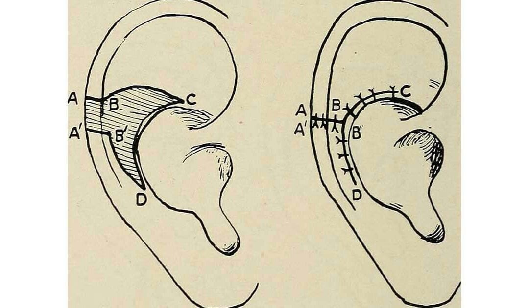 Prominent Ears? - FACEMED Cosmetic, Medical & Dental Centre